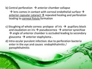 Ferdous bacterial keratitis copy | PPT