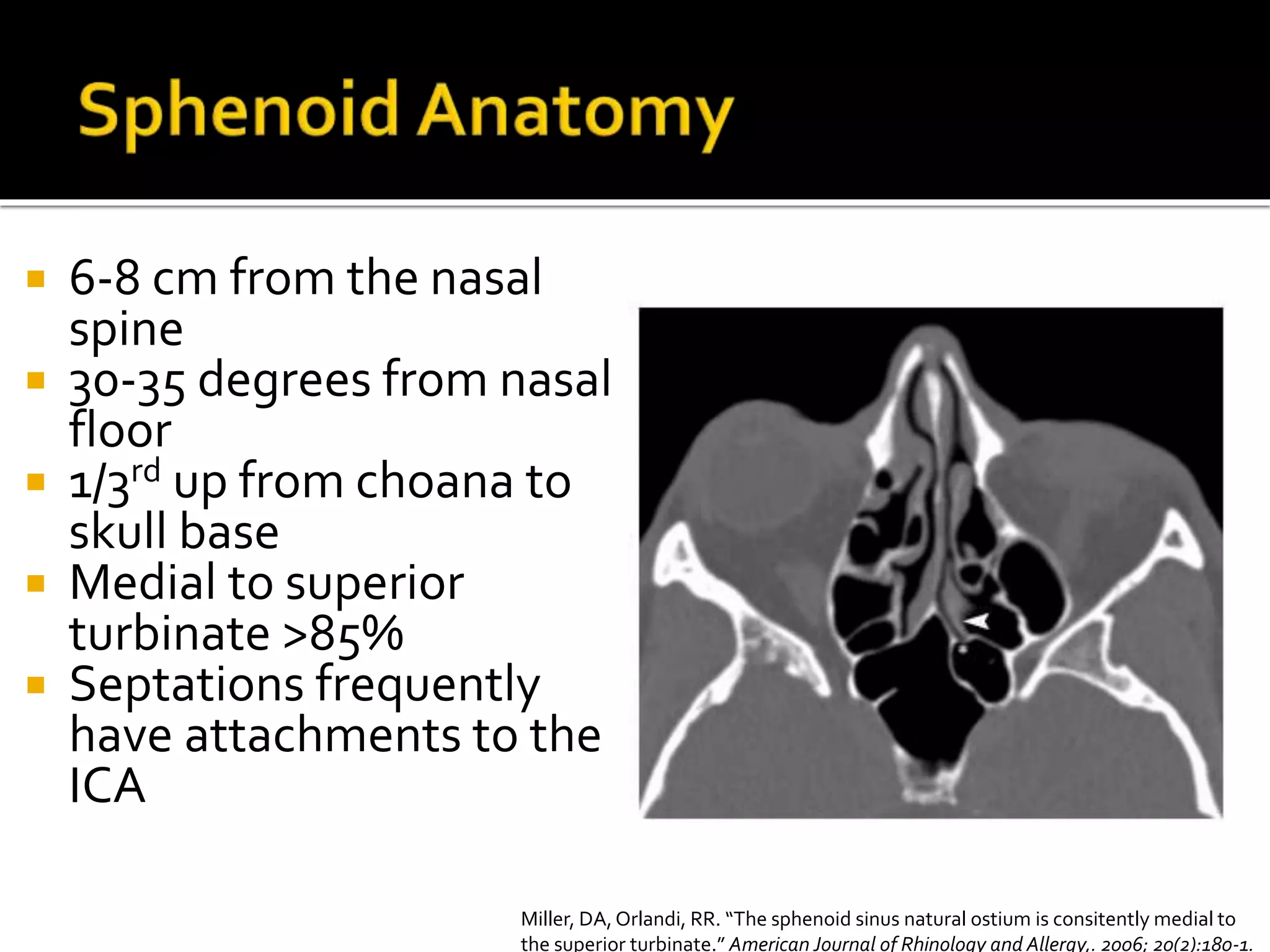 Sinus Anatomy Lectures: Western Residents Advanced Endsocopic Sinus ...