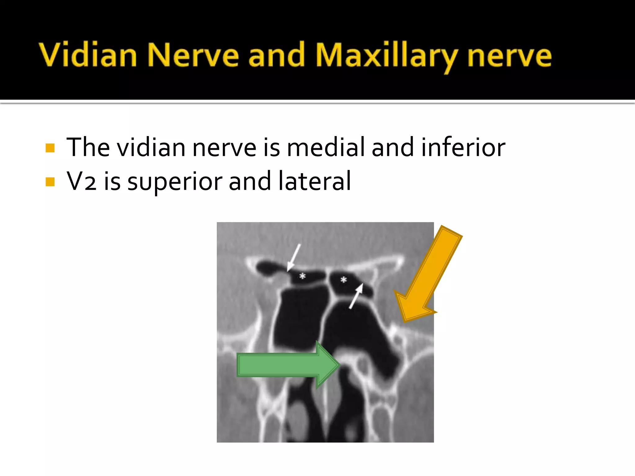 Sinus Anatomy Lectures: Western Residents Advanced Endsocopic Sinus ...