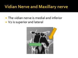 Sinus Anatomy Lectures: Western Residents Advanced Endsocopic Sinus ...