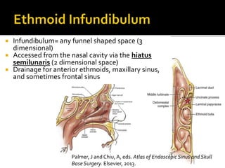 Ethmoid Infundibulum