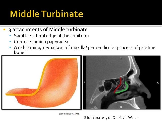 Sinus Anatomy Lectures: Western Residents Advanced Endsocopic Sinus S…