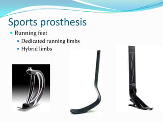 Fergus Jepson @ MRF Childhood Amputee Day - Pushing the Boundaries | PPT