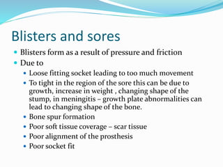 Prosthetics workshop | PPT