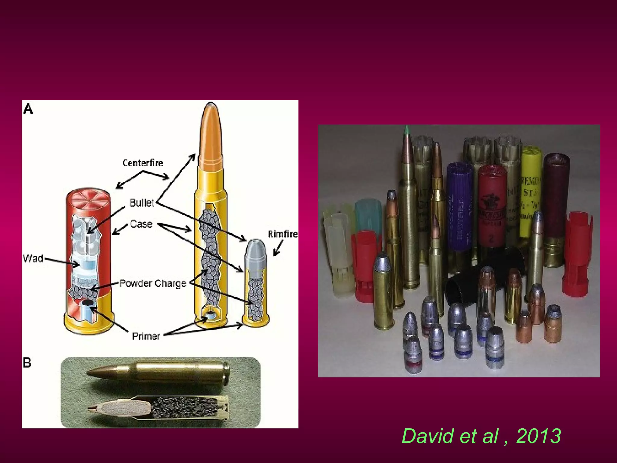 Ferimento por arma de fogo | PPT