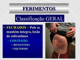 Ferimentos Perfuros Cortantes.ppt para saude | PPT