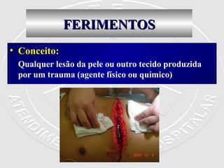 Ferimentos Perfuros Cortantes.ppt para saude | PPT