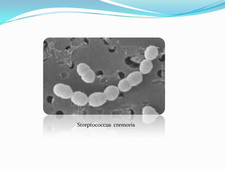 Streptococcus Cremoris
