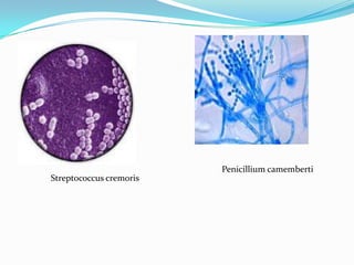 Streptococcus Cremoris