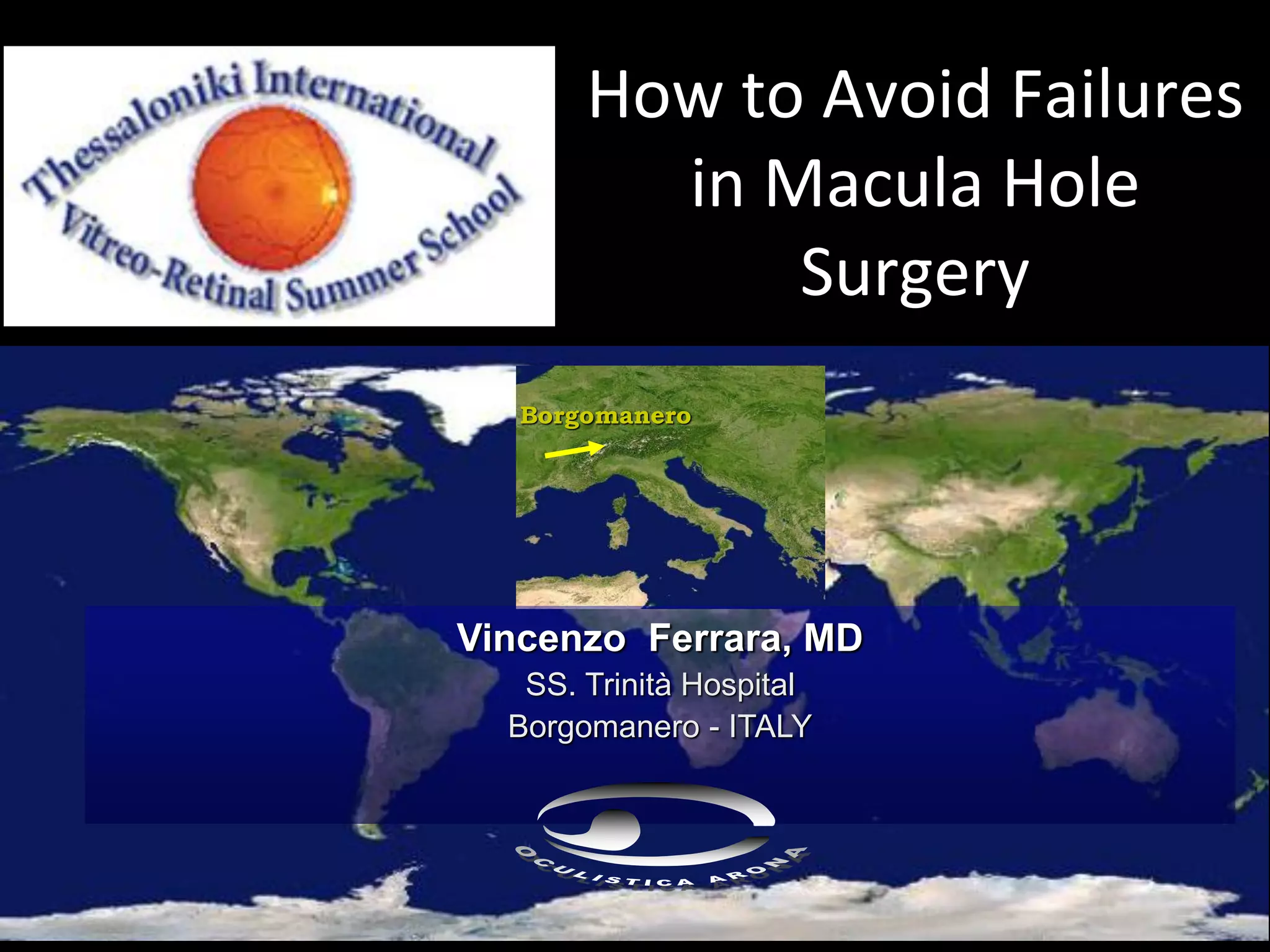 Ferrara how to avoid failure in macula hole surgery | PPT