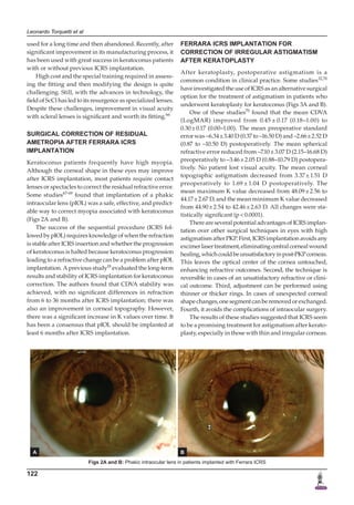 Ferrara ring review (2017) | PDF