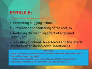 Ferrule 3 | PPTX