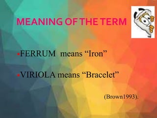 Ferrule 3 | PPT