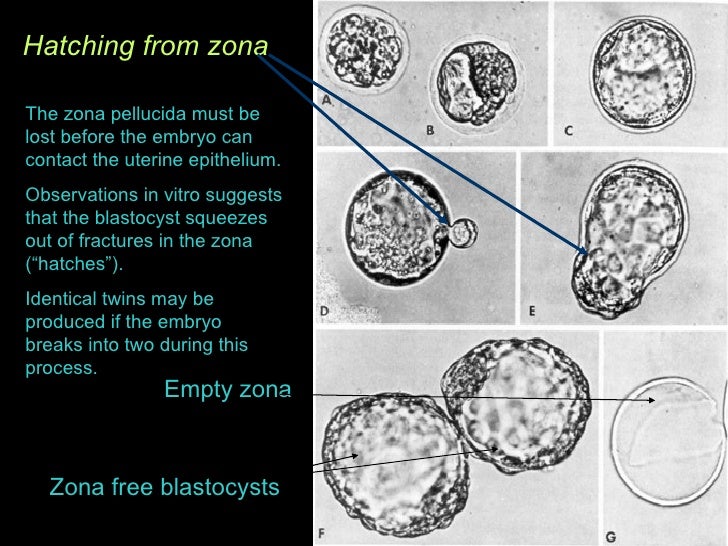 Fertility Options: IVF Overview