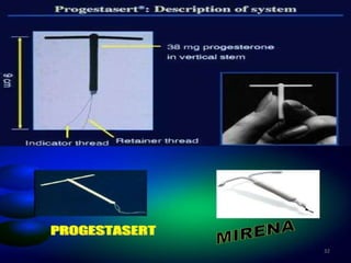 Fertility control (Contraception) | PPTX
