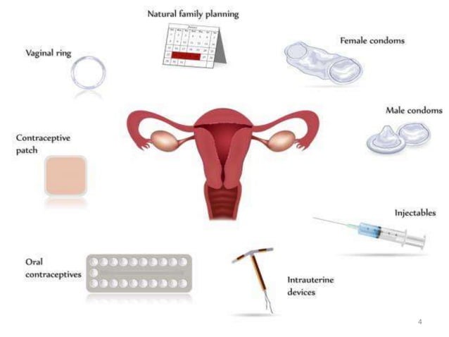 Fertility control (Contraception) | PPTX