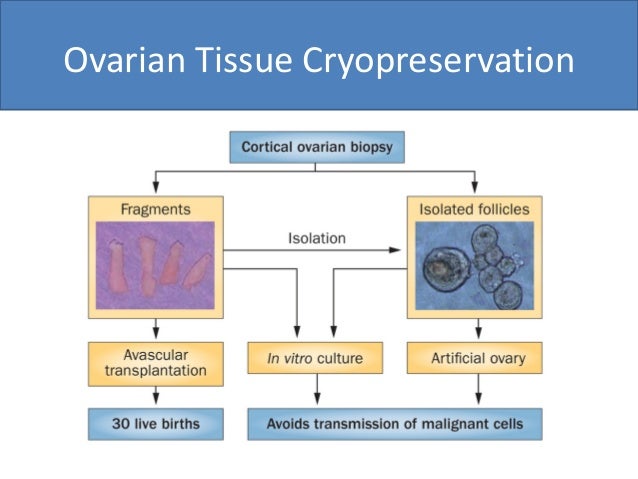 Fertility preservation 3
