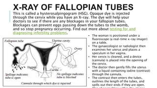Fertility tests | PPTX