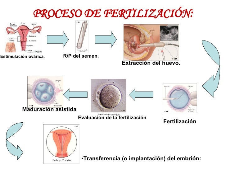 Fertilizacion In Vitro