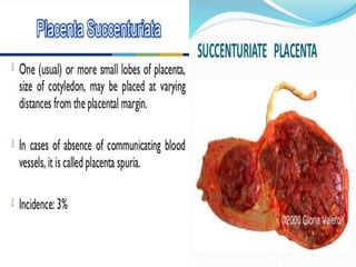 Placenta Spuria