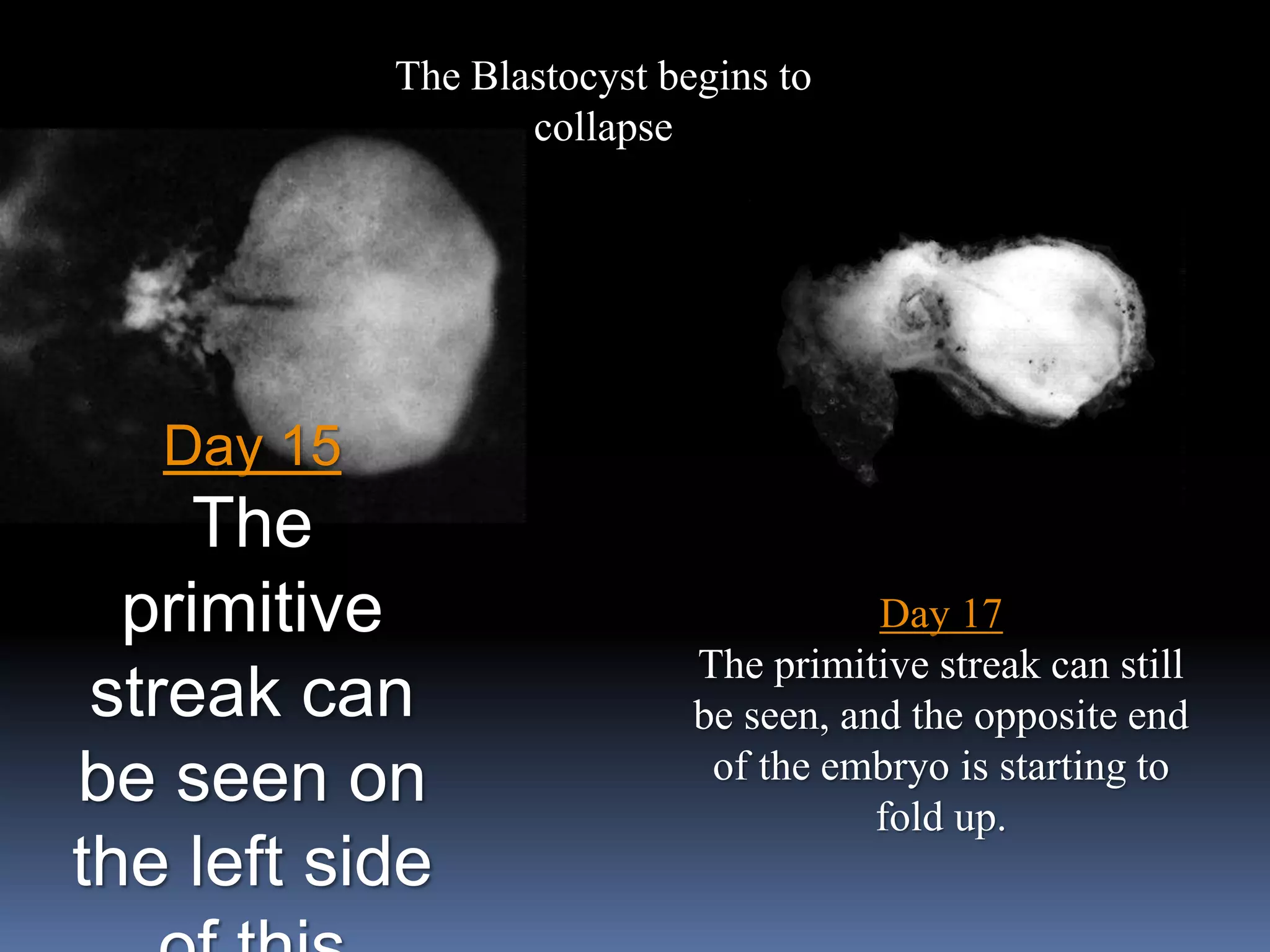 Fertilization,implantation and fetal development | PPTX