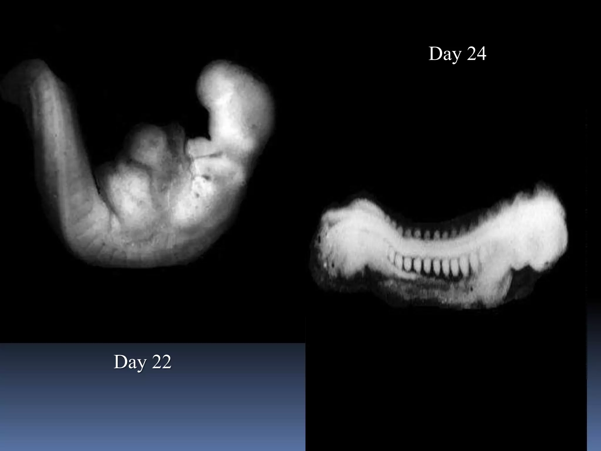 Fertilization Implantation And Fetal Development Pptx