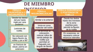 Realización y colocación correcta de férulas | PPTX