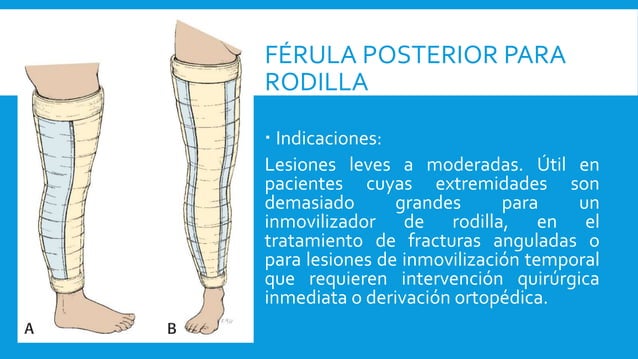 INMOVILIZACIONES CON FERULA DE YESO.pptx