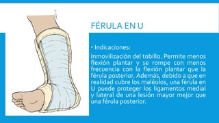 INMOVILIZACIONES CON FERULA DE YESO.pptx