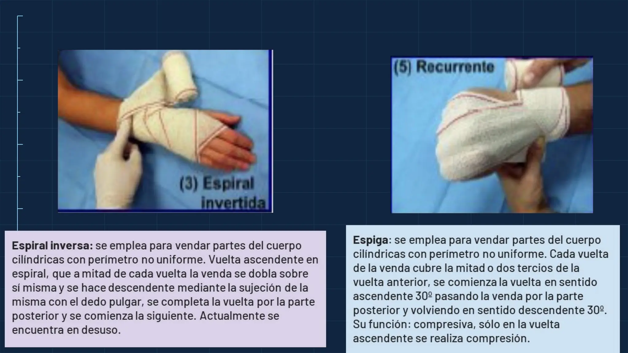 FERULAS E INMOVILIZACIONES.pdf, traumatología y ortopediA | PDF