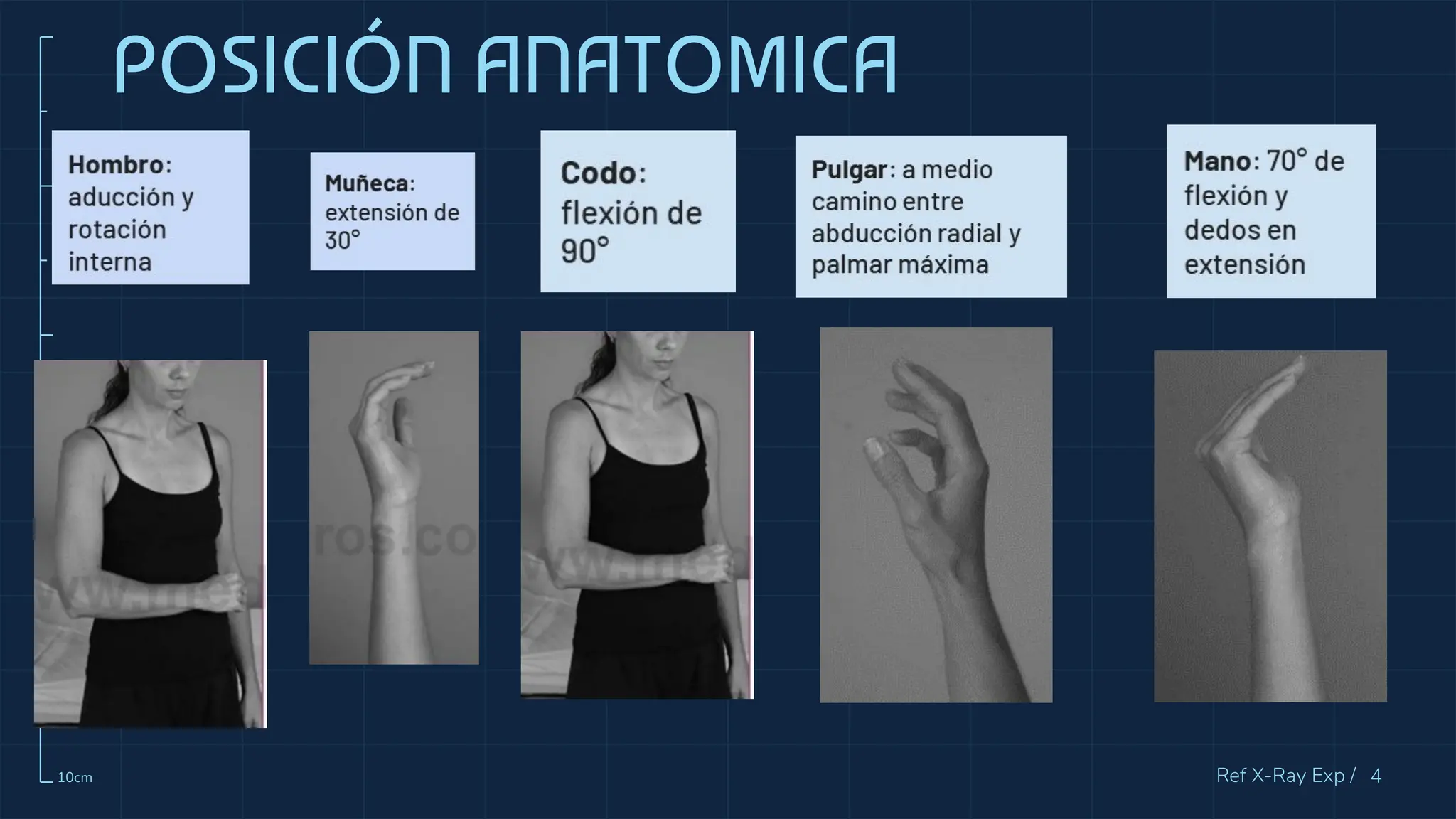FERULAS E INMOVILIZACIONES.pdf, traumatología y ortopediA | PDF