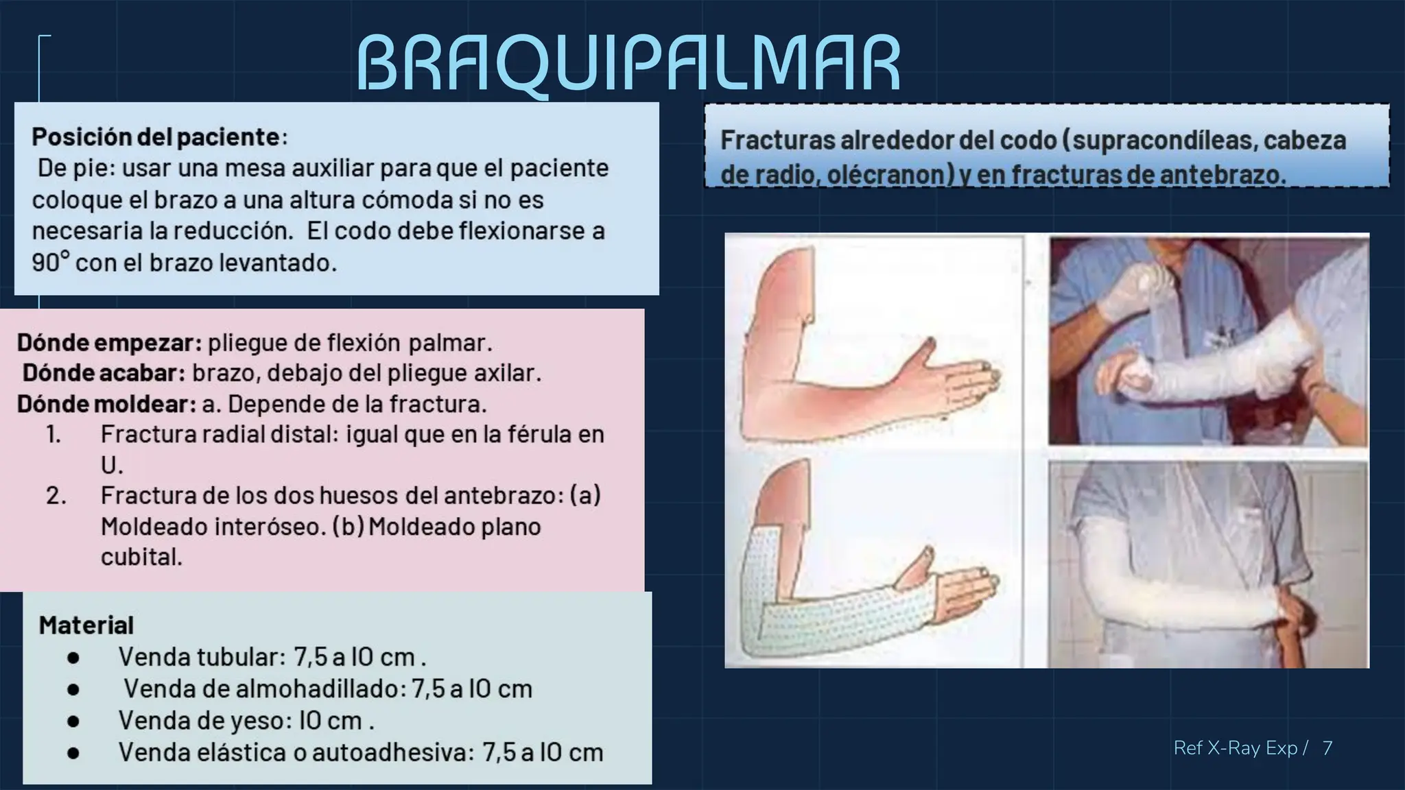 FERULAS E INMOVILIZACIONES.pdf, traumatología y ortopediA | PDF