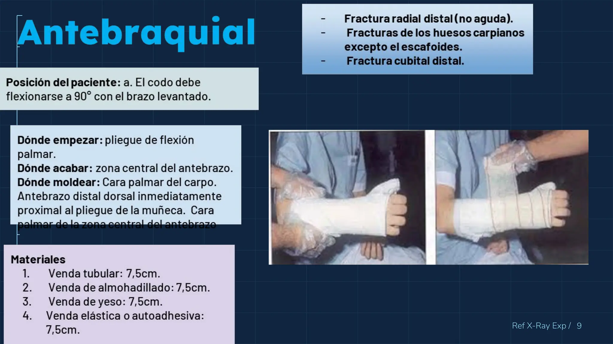 FERULAS E INMOVILIZACIONES.pdf, traumatología y ortopediA | PDF