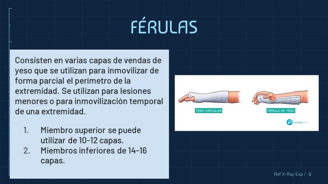 FERULAS E INMOVILIZACIONES.pdf, traumatología y ortopediA | PDF ...