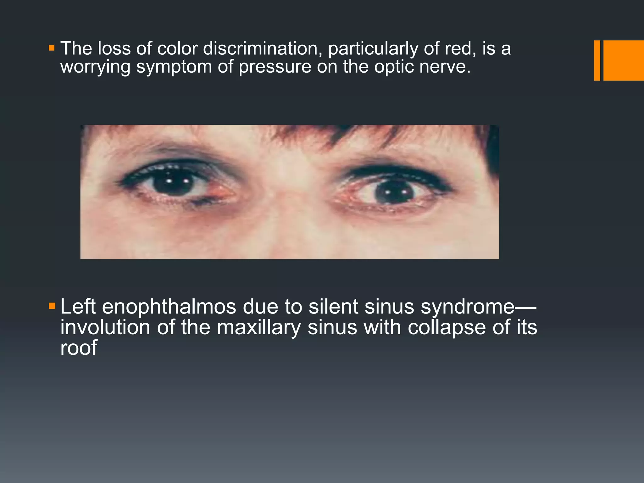 FESS - Functional endoscopic sinus surgery | PPTX