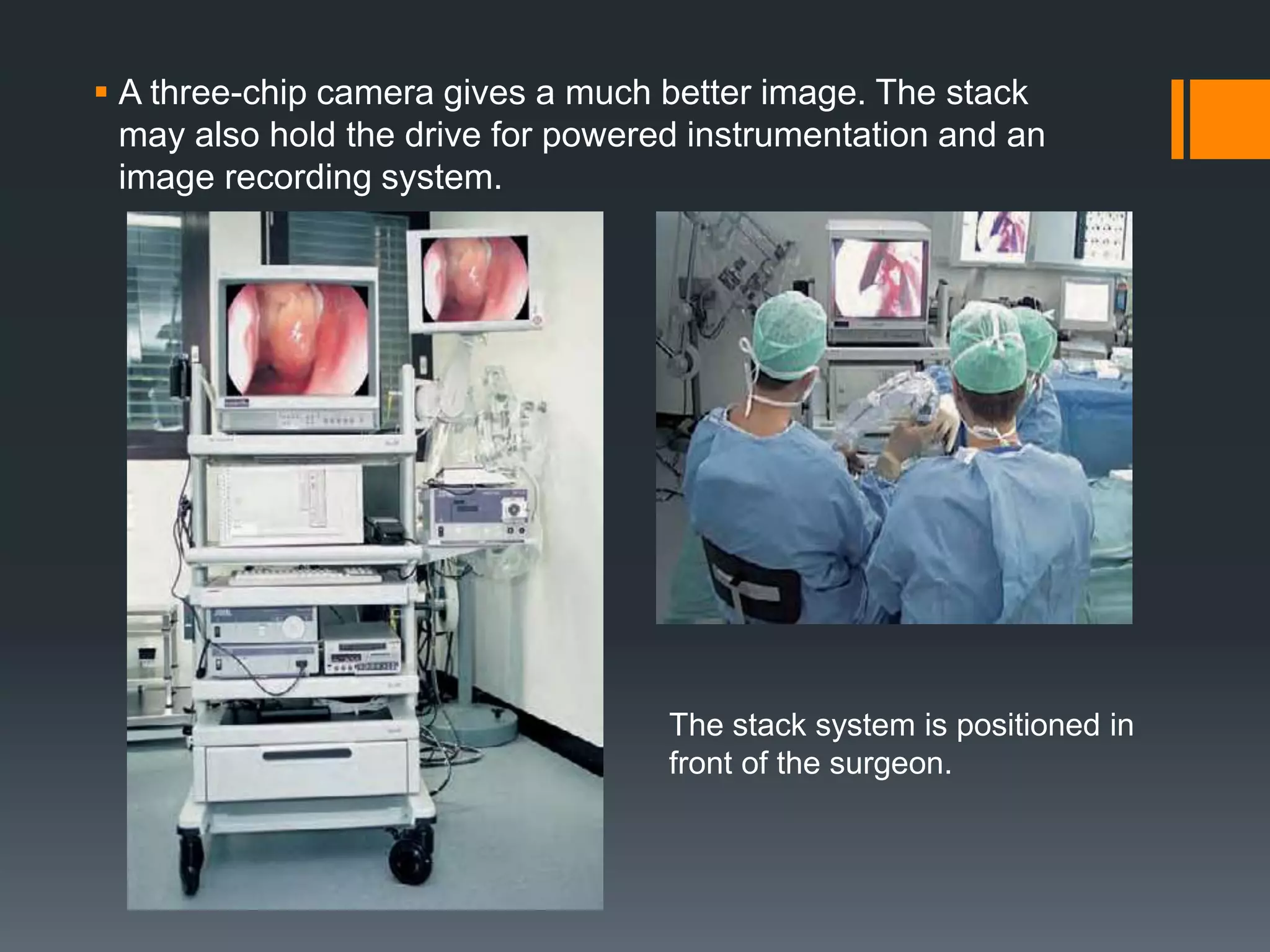 FESS - Functional endoscopic sinus surgery | PPTX