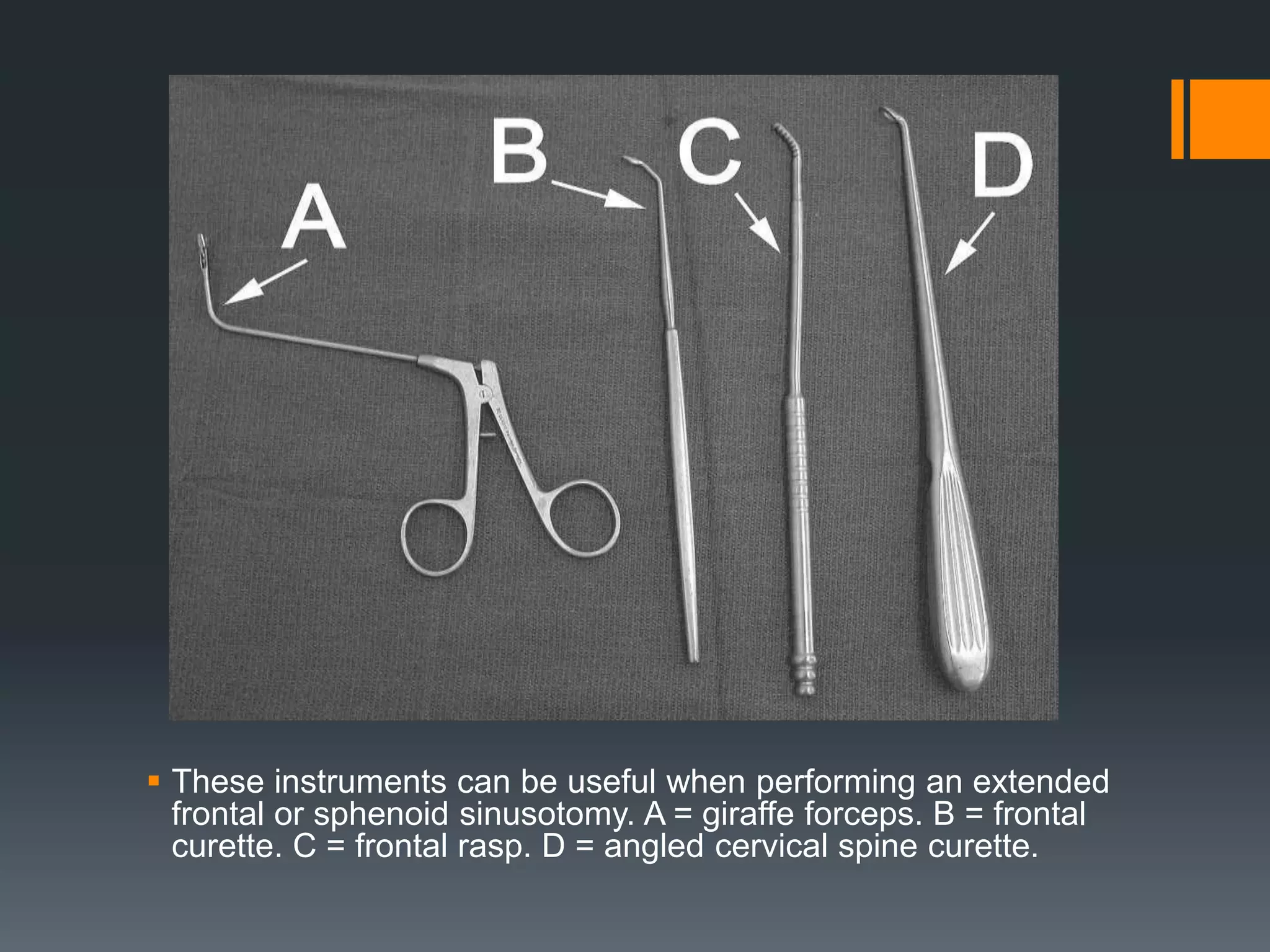FESS - Functional endoscopic sinus surgery | PPTX
