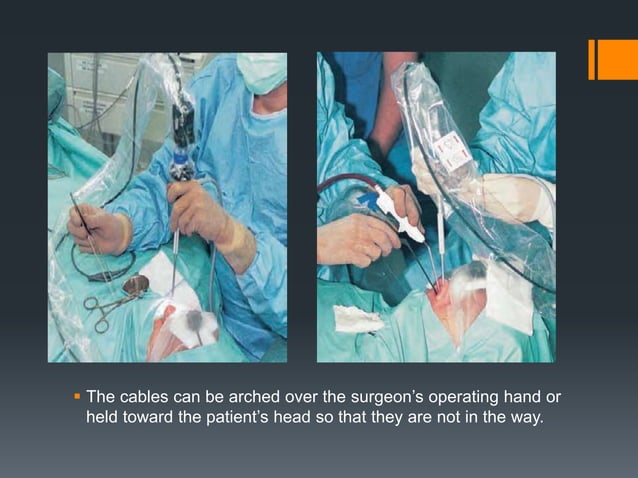 FESS - Functional endoscopic sinus surgery | PPTX