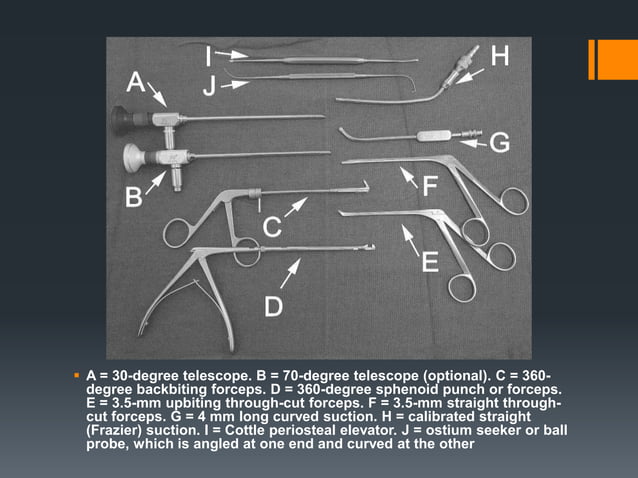 FESS - Functional endoscopic sinus surgery | PPTX