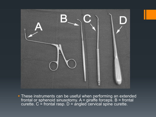 FESS - Functional endoscopic sinus surgery | PPTX