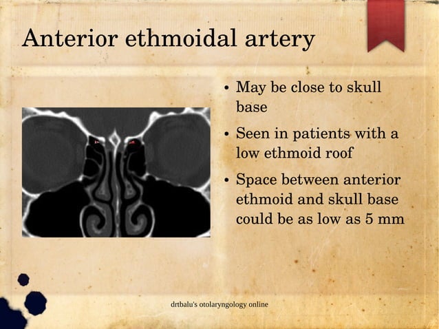 How to reduce bleeding during Endoscopic sinus surgery | ODP