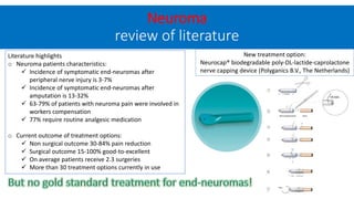 STOP Neuroma, first results of Dutch trial. | PPT