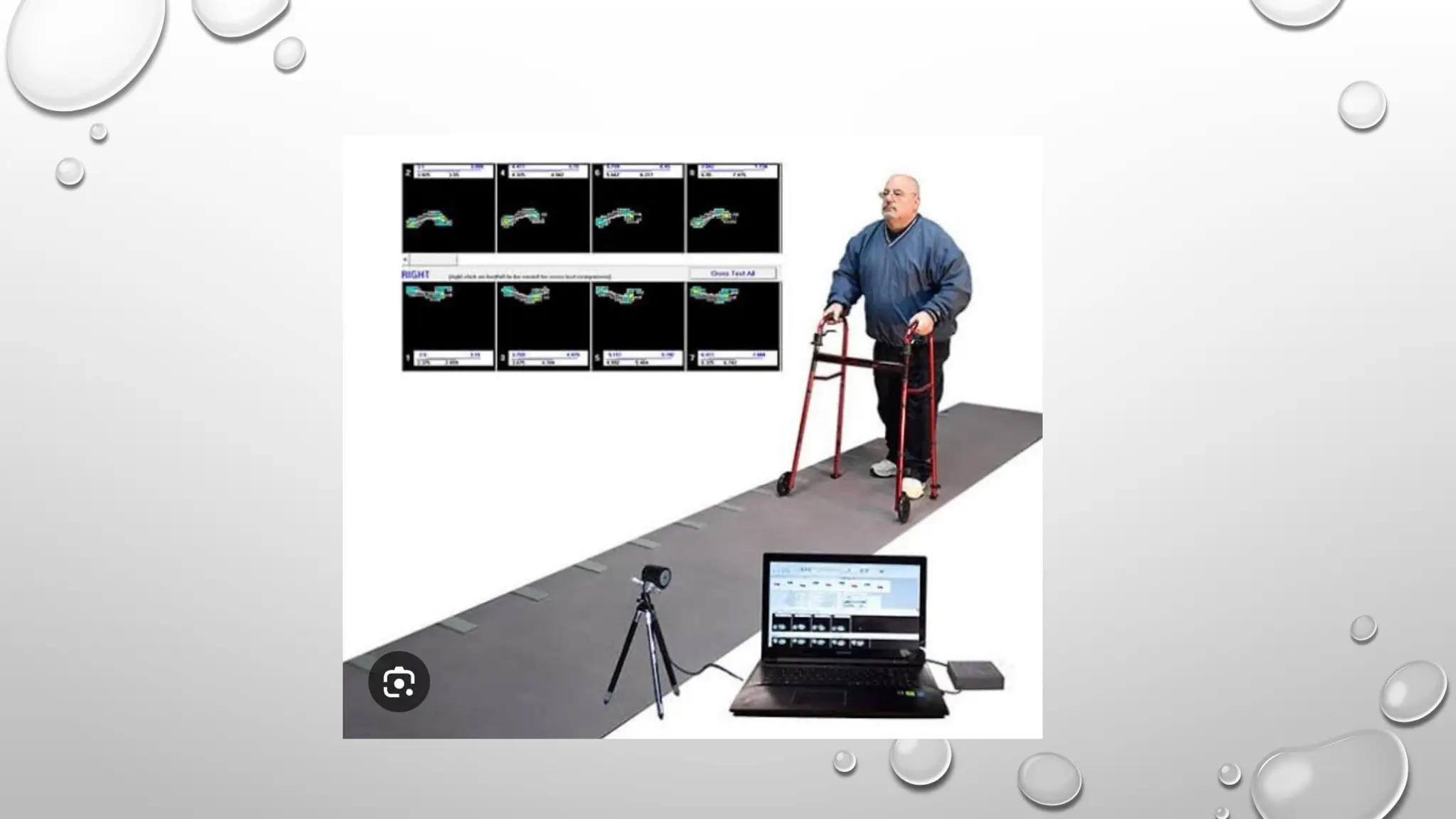 Festinating gait and it's physiotherapy management | PPTX