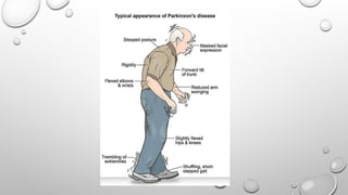 Festinating gait and it's physiotherapy management | PPTX | Physical ...