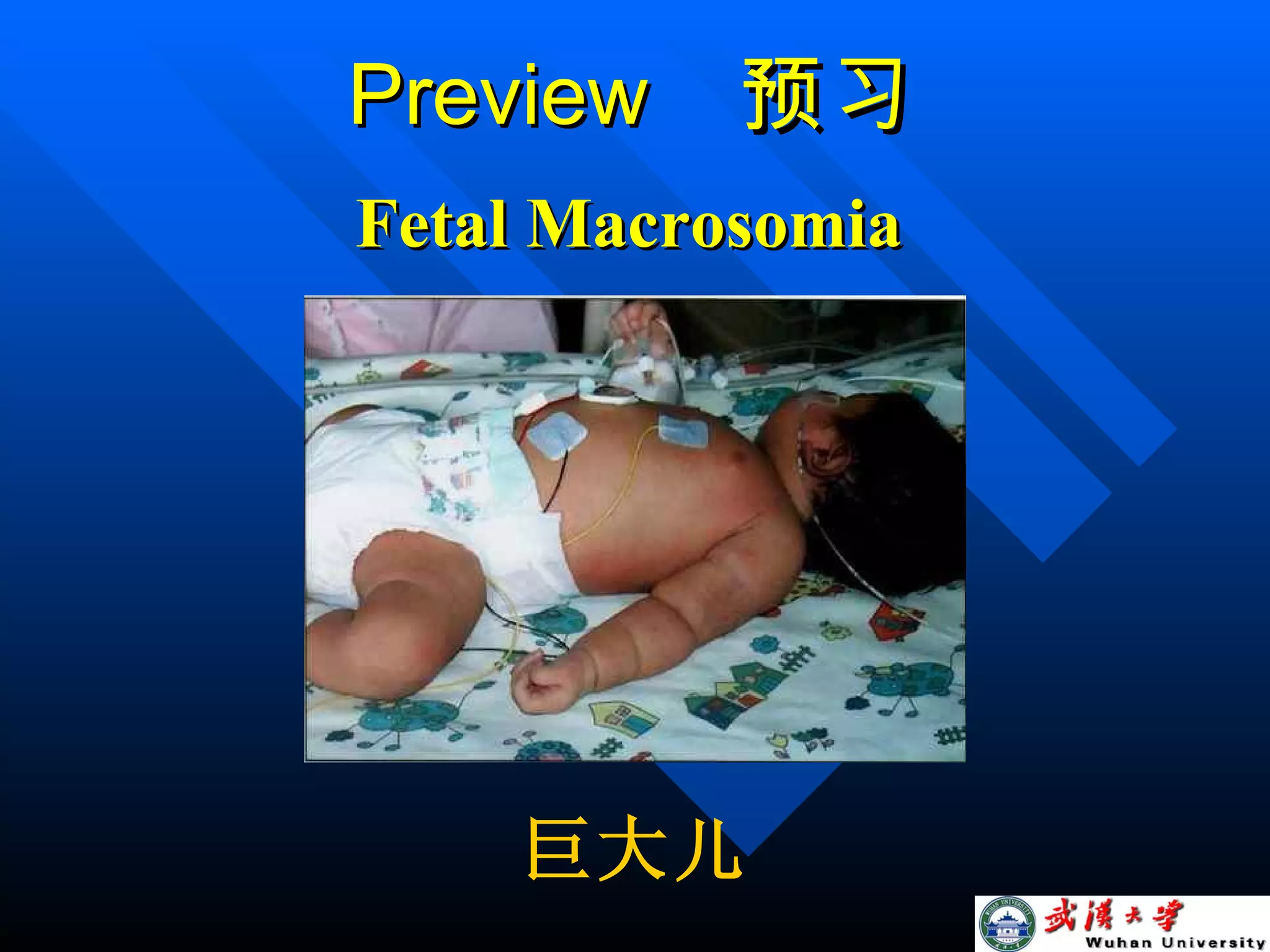 Fetal Growth Restriction(Fgr)改 | PPT
