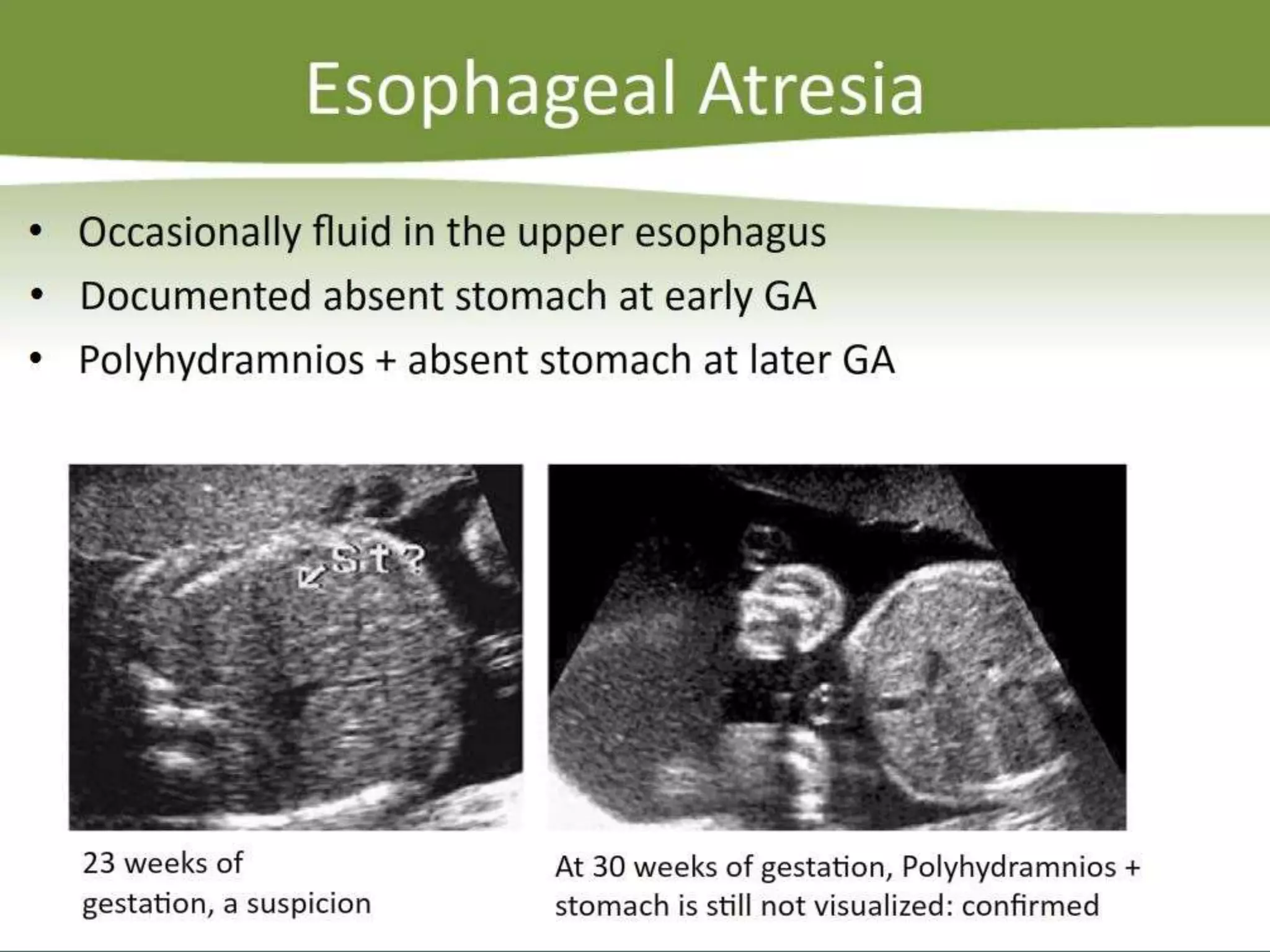 Fetal abdomen usg | PPTX