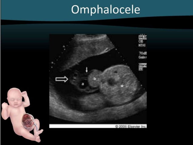 Fetal abdomen usg | PPTX | Pregnancy | Reproductive Health