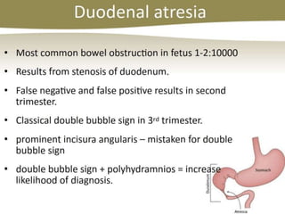 Fetal abdomen usg | PPTX