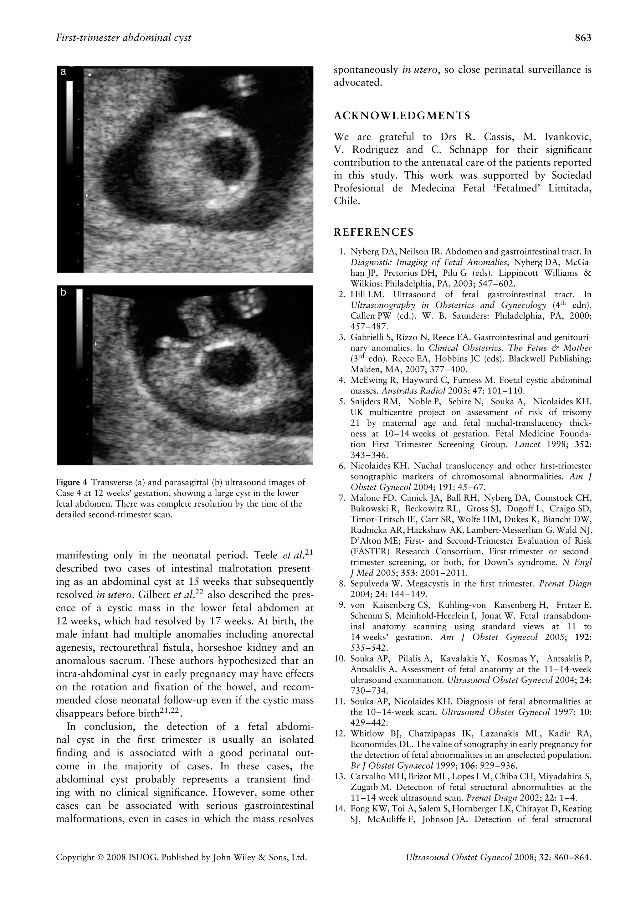 Fetal abdominal cysts | PDF