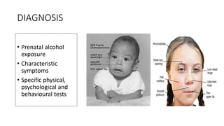 Fetal alcohol syndrome PPT.pptx